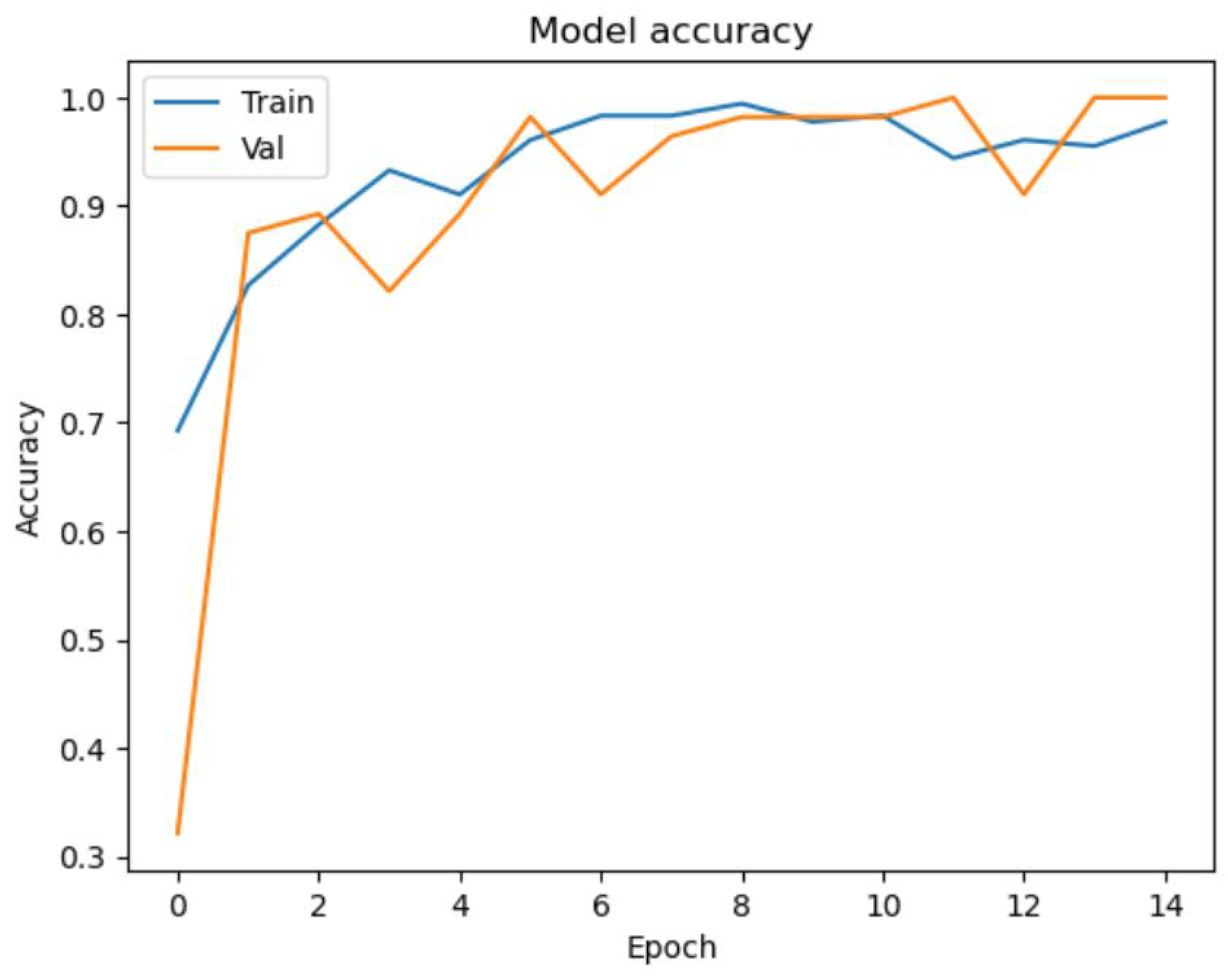 Explainable AI for Retinoblastoma Diagnosis: Interpreting Deep Learning ...