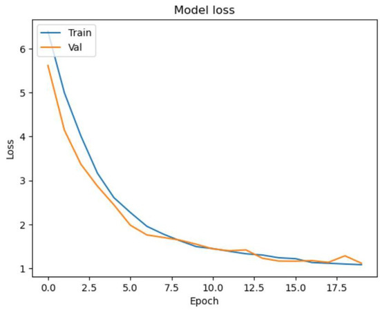 Explainable AI for Retinoblastoma Diagnosis: Interpreting Deep Learning ...
