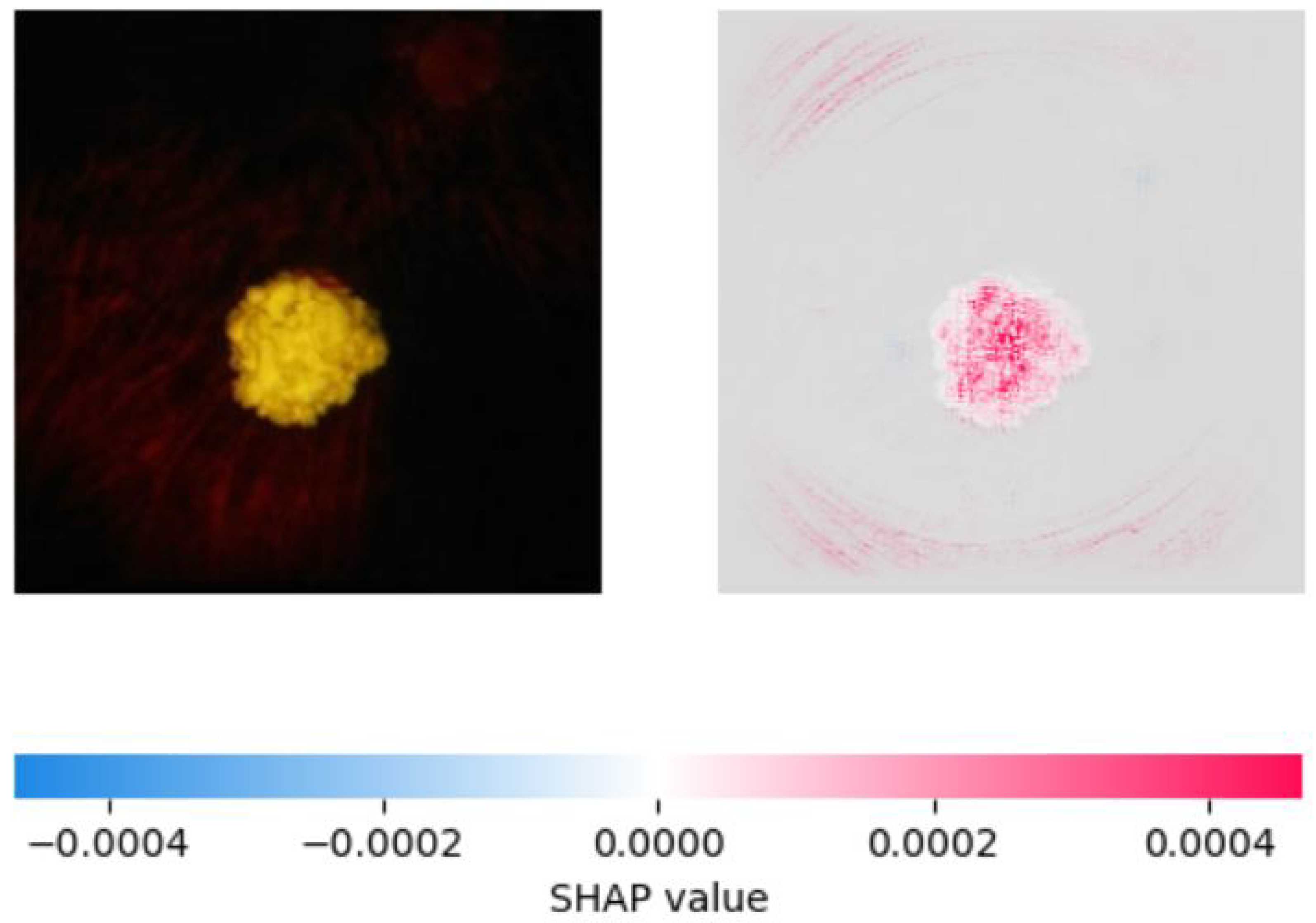 Explainable AI for Retinoblastoma Diagnosis: Interpreting Deep Learning ...
