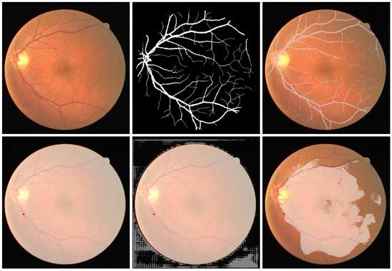 Generalist Vision Foundation Models for Medical Imaging: A Case Study of Segment Anything Model ...