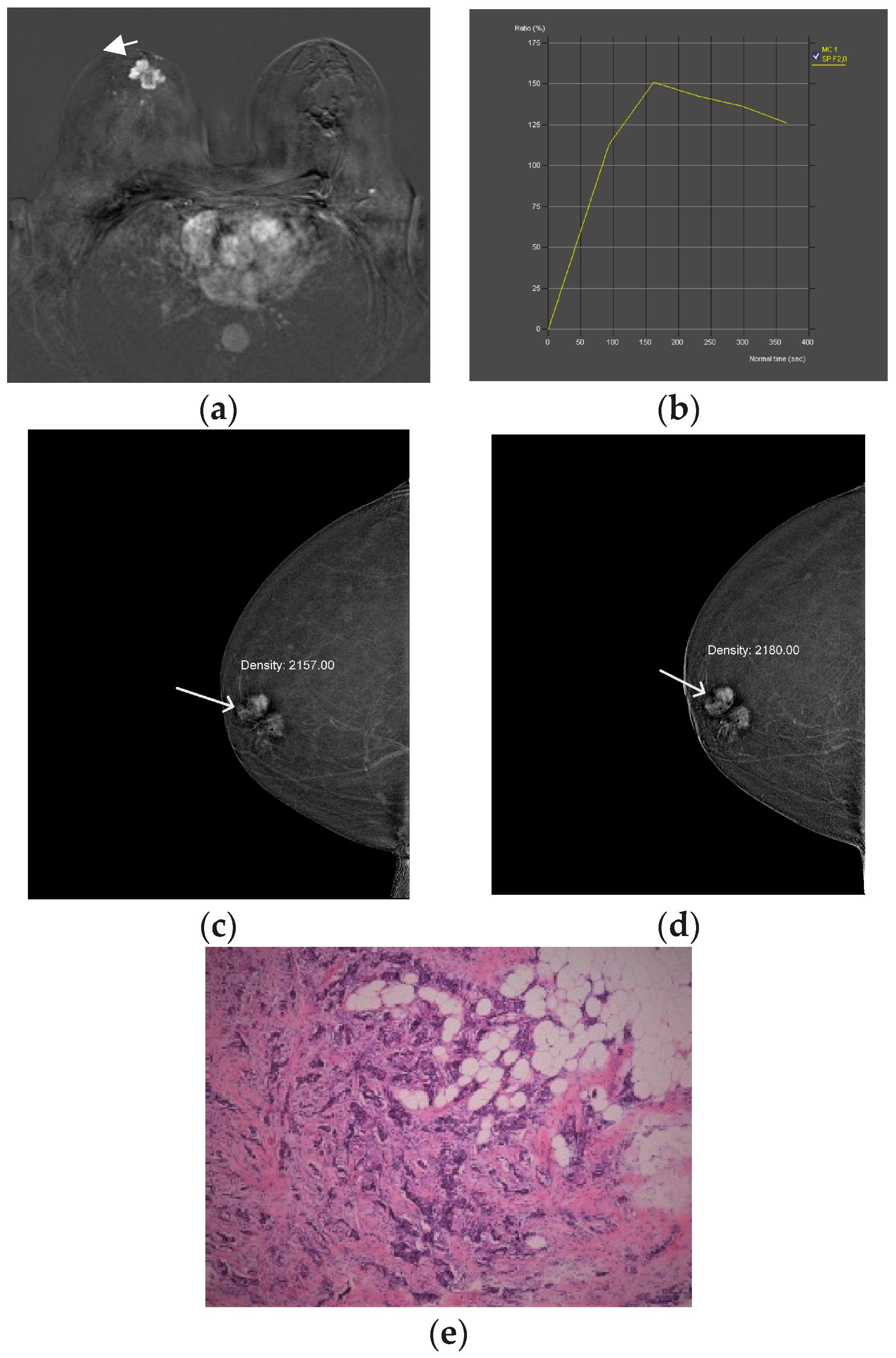 Diagnostics | Free Full-Text | Evaluation of Contrast-Enhanced ...