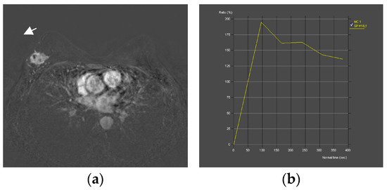 Diagnostics | Free Full-Text | Evaluation of Contrast-Enhanced Mammography and Development of ...