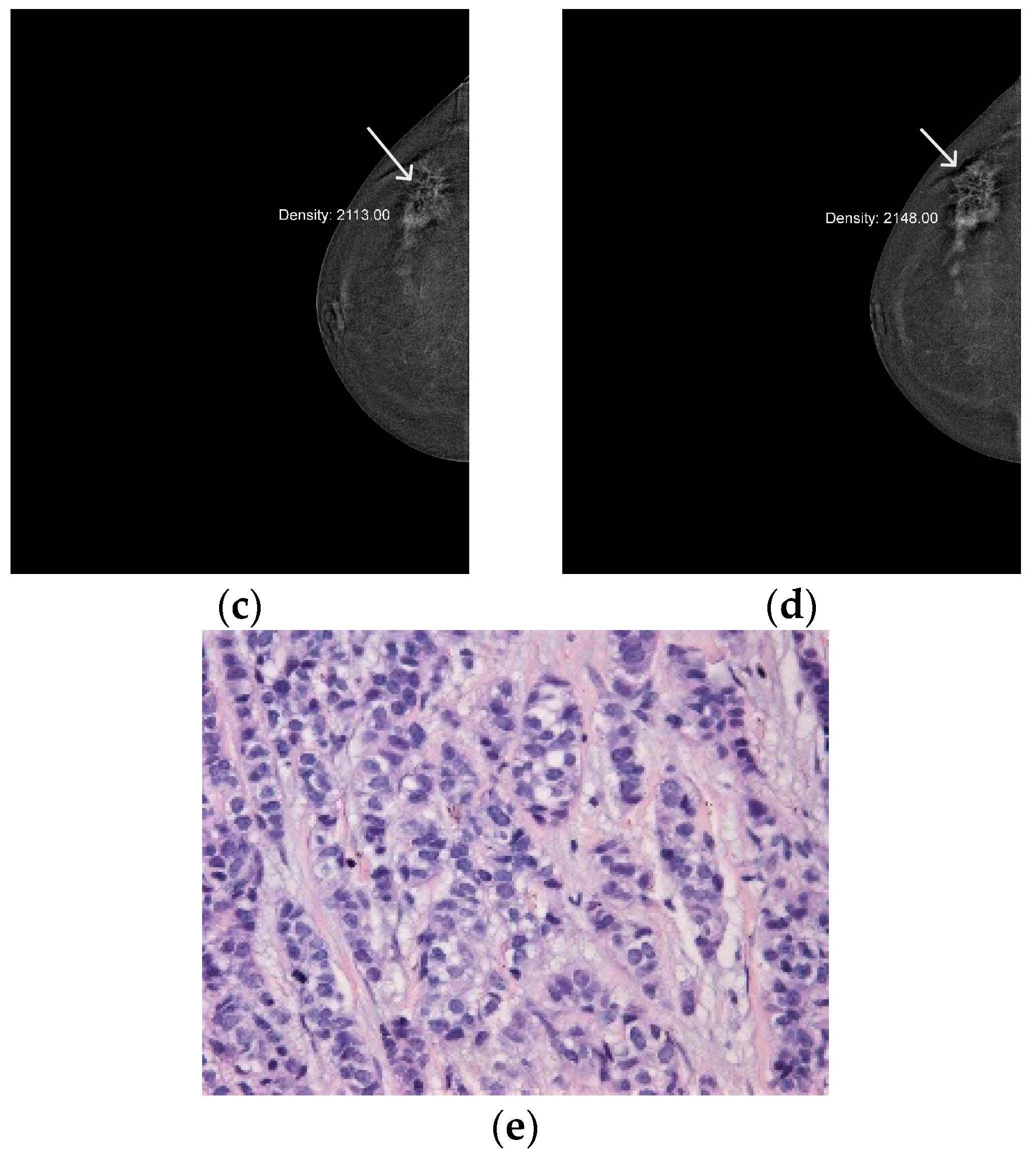 Diagnostics | Free Full-Text | Evaluation of Contrast-Enhanced ...