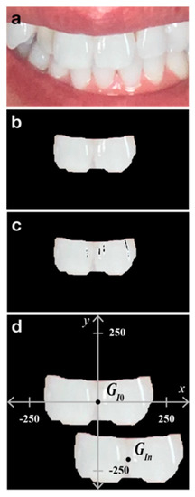 A Smartphone Application for Personalized Tooth Shade Determination