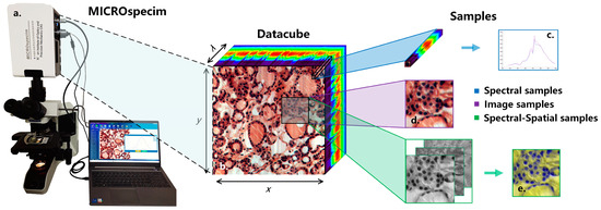 Joint Diagnostic Method of Tumor Tissue Based on Hyperspectral Spectral ...