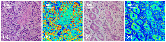 Joint Diagnostic Method of Tumor Tissue Based on Hyperspectral Spectral ...