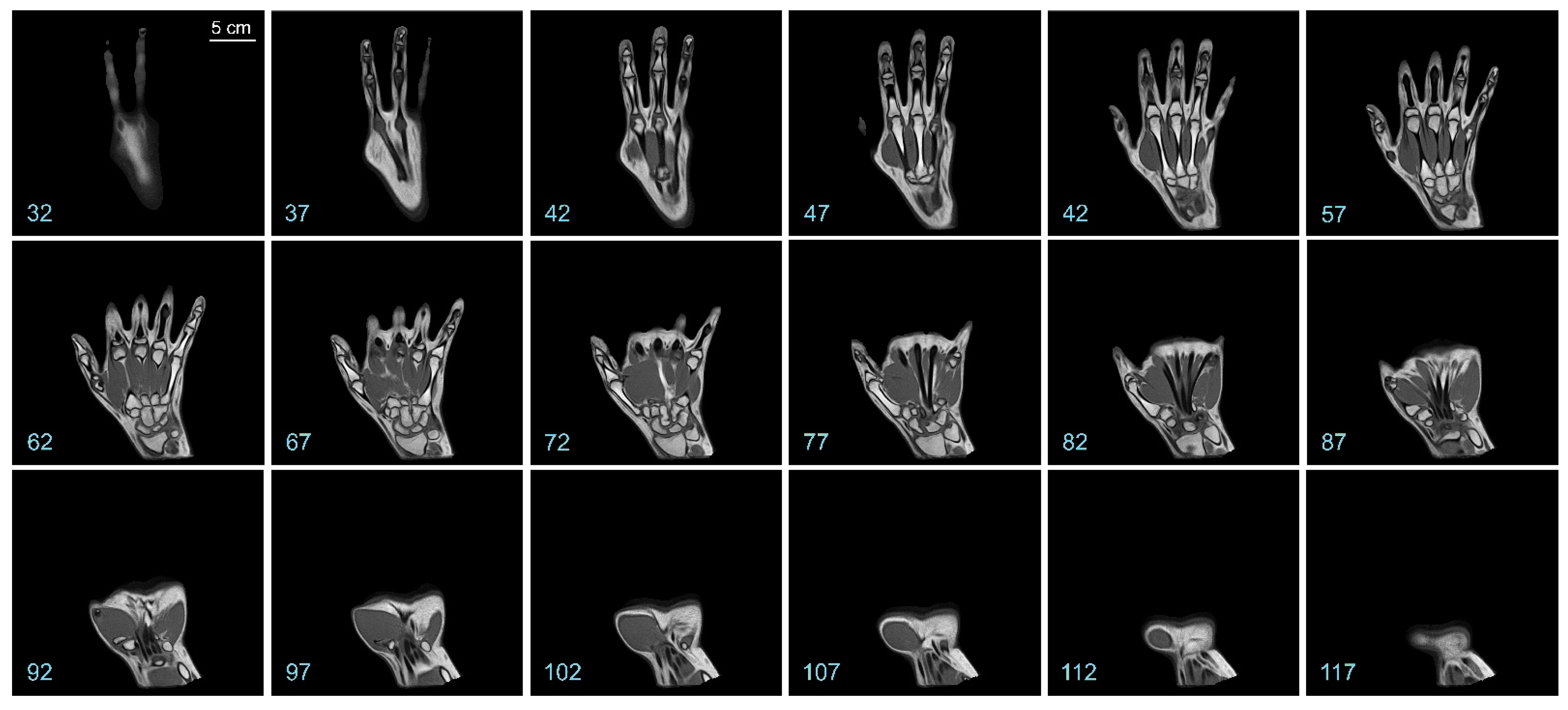 An Anatomical Template for the Normalization of Medical Images of Adult ...