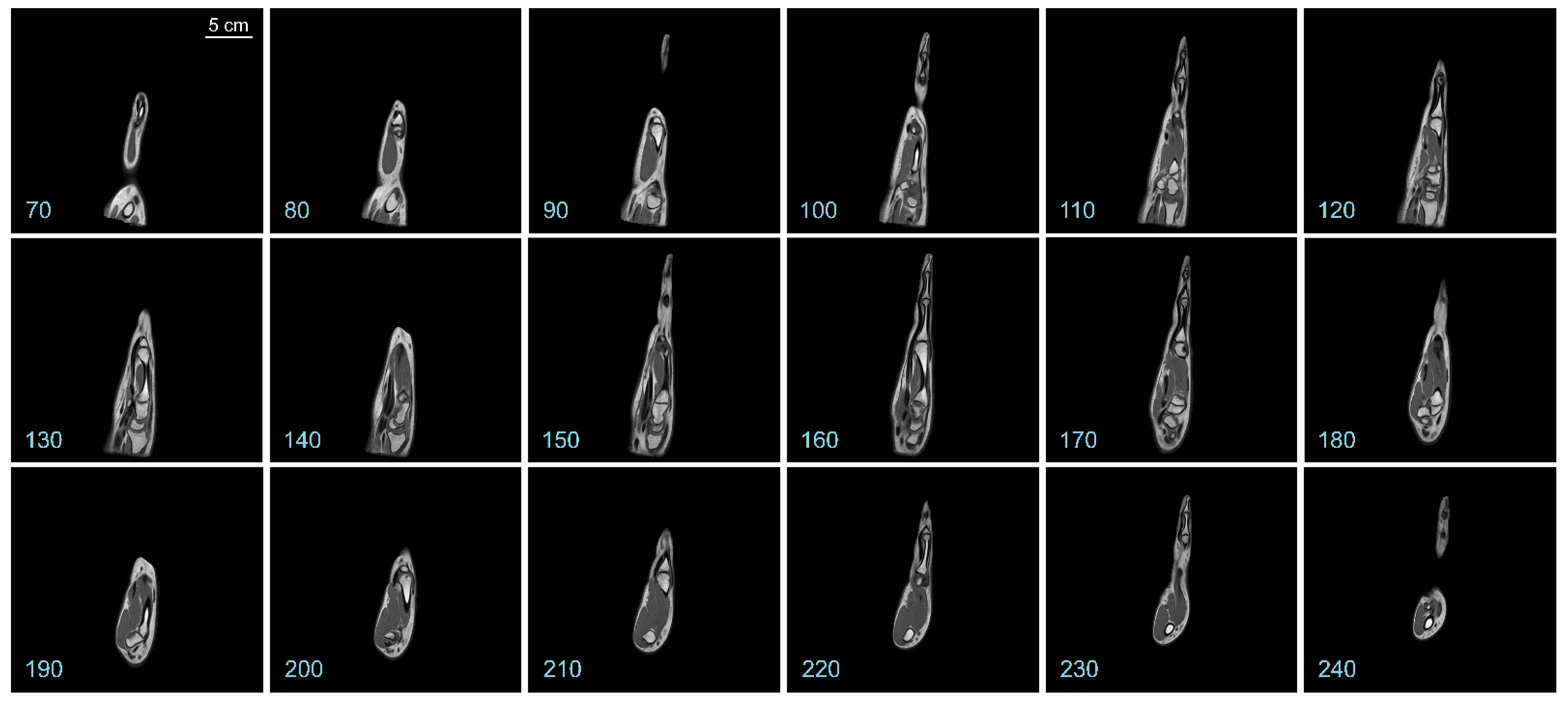 An Anatomical Template for the Normalization of Medical Images of Adult ...