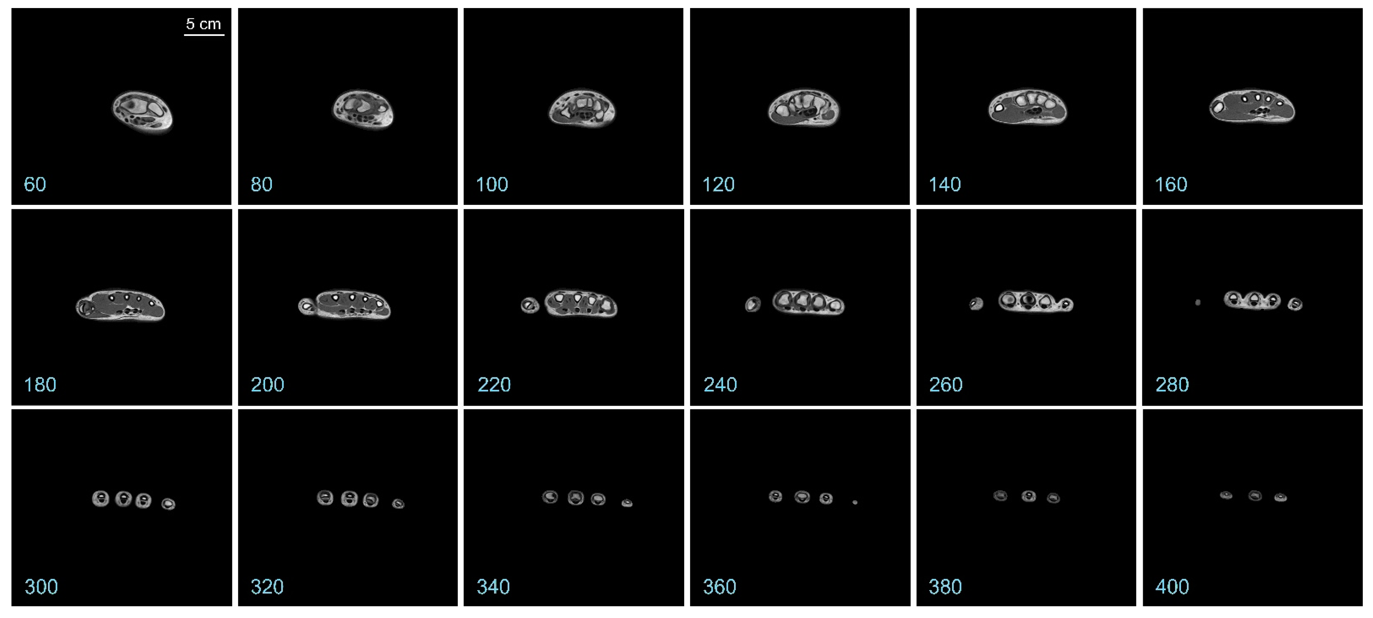 An Anatomical Template for the Normalization of Medical Images of Adult ...