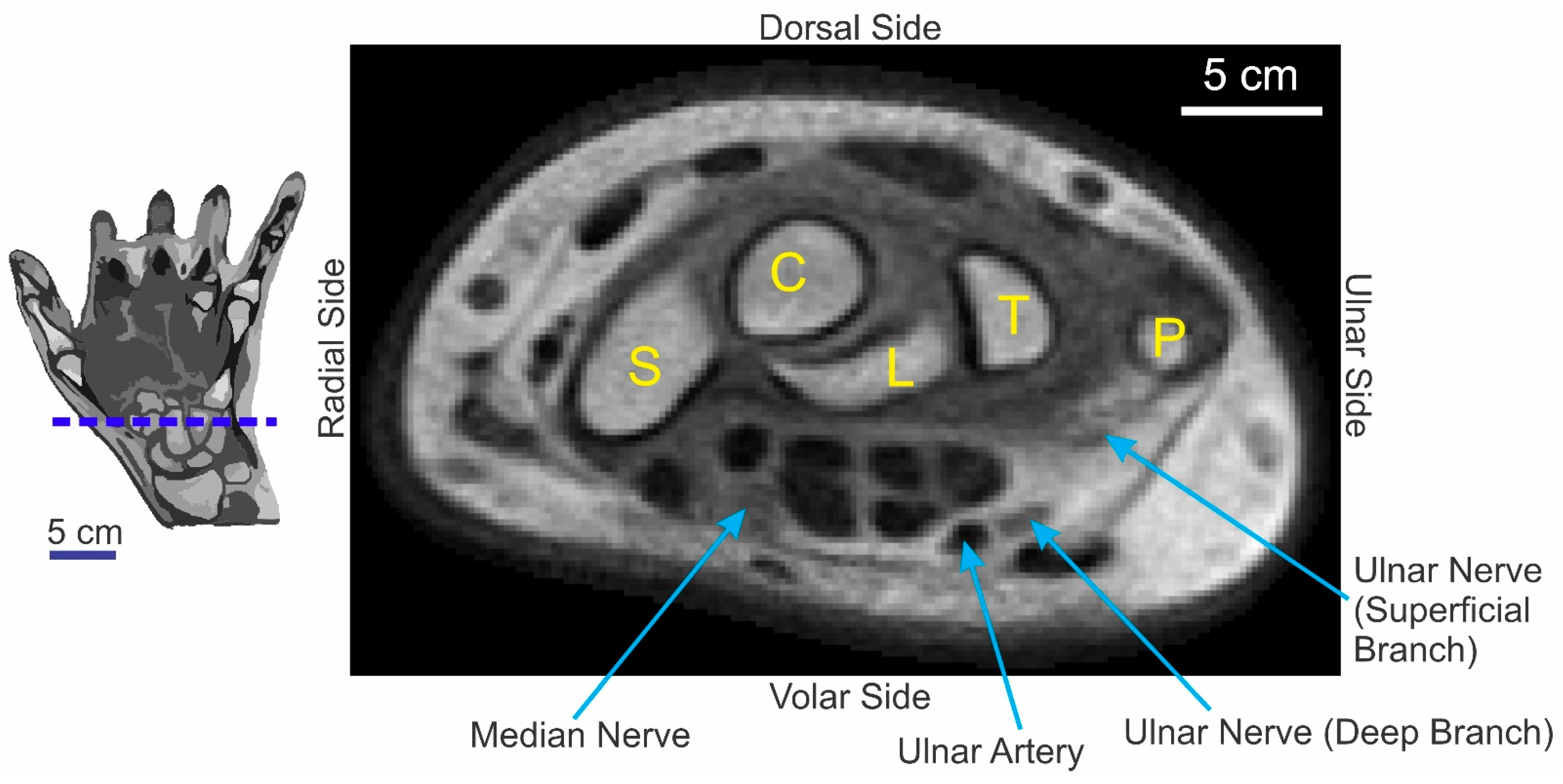 An Anatomical Template for the Normalization of Medical Images of Adult ...