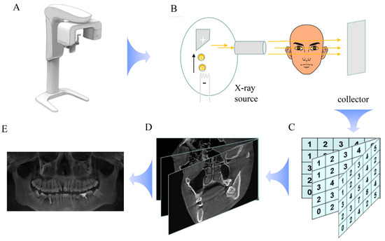 Diagnostics | Free Full-Text | The Application of Deep Learning on CBCT in Dentistry