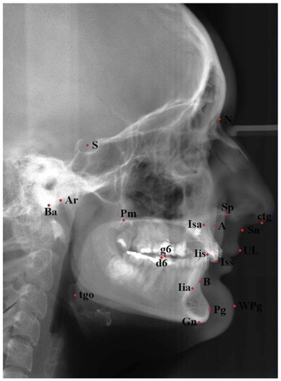 Craniofacial Cephalometric Morphology in Caucasian Adult Patients with ...
