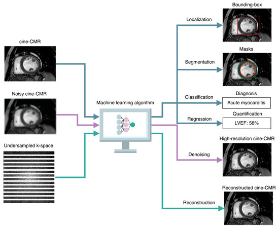 Artificial Intelligence Applications in Cardiovascular Magnetic ...