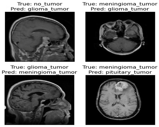 Exploring the Power of Deep Learning: Fine-Tuned Vision Transformer for ...