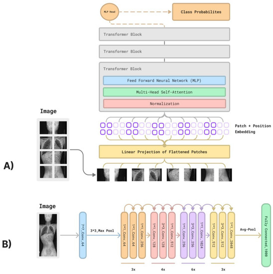 Evaluating Scoliosis Severity Based on Posturographic X-ray Images Using a Contrastive Language ...