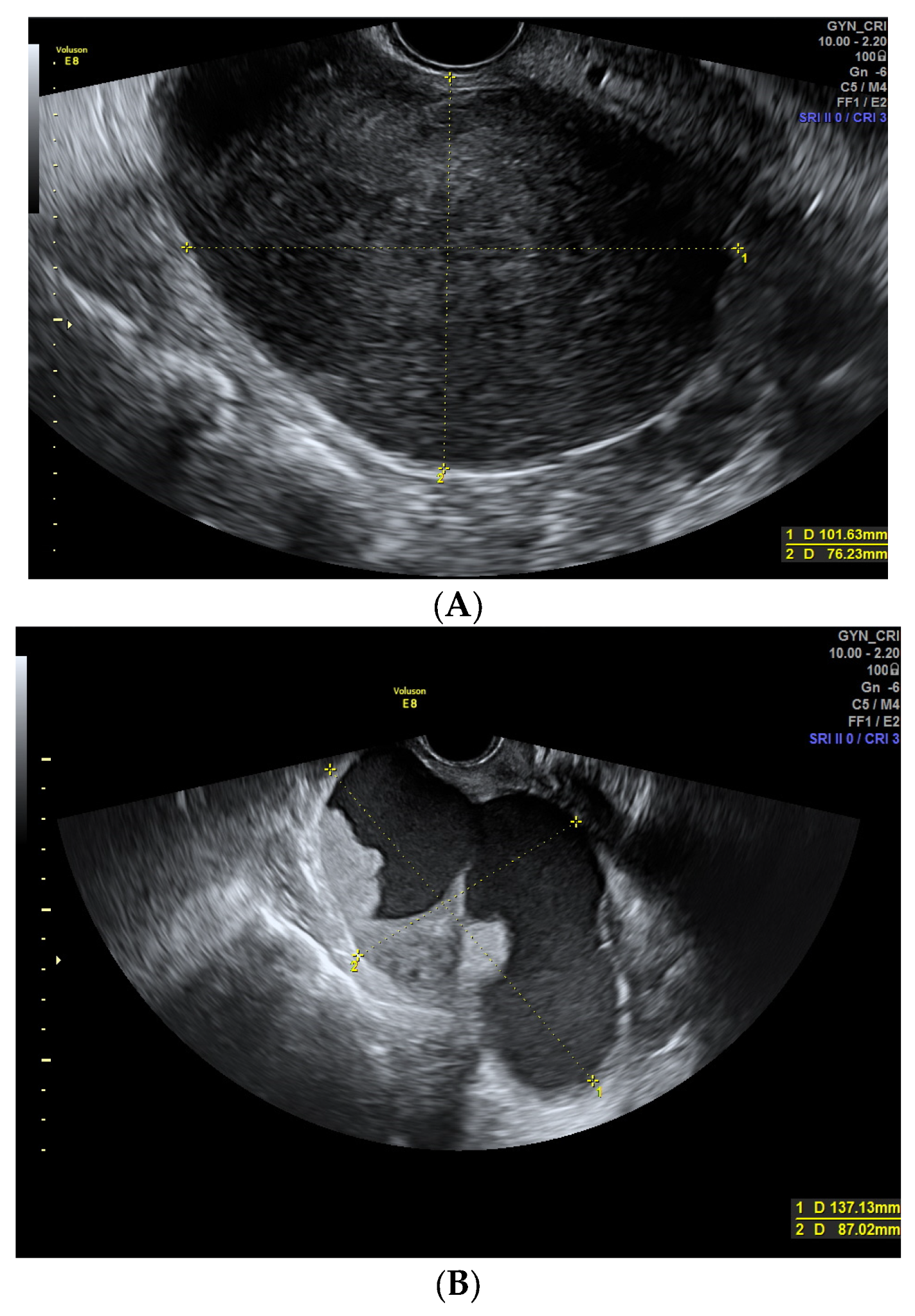 Diagnostics Free Full Text Ultrasound Features And Ultrasound Scores In The Differentiation
