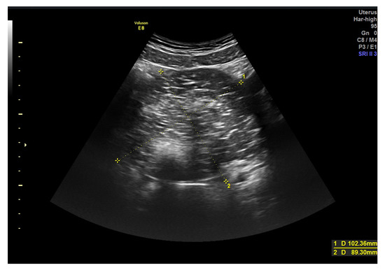 Ultrasound Features and Ultrasound Scores in the Differentiation ...