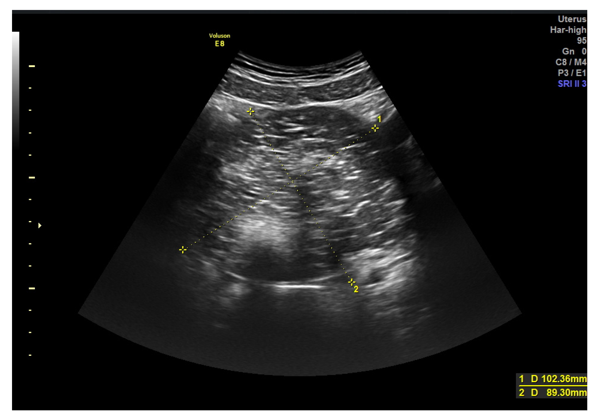 Diagnostics Free Full Text Ultrasound Features And Ultrasound