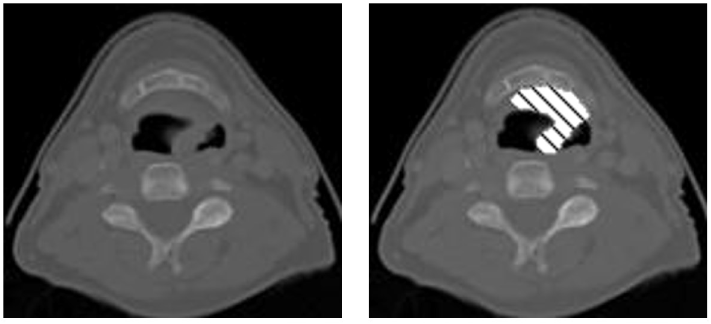 Diagnostics | Free Full-Text | Deep Learning Architecture to Improve ...