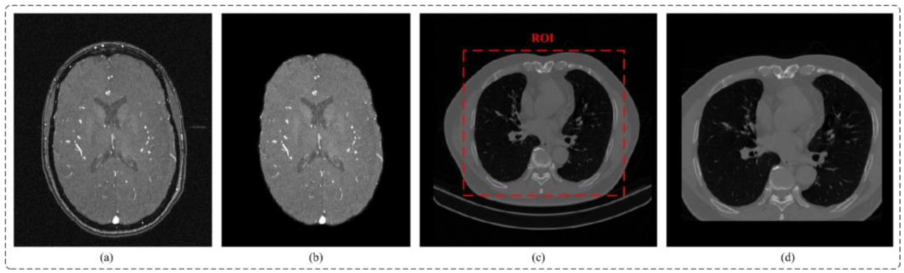 Diagnostics | Free Full-Text | Tubular Structure Segmentation via Multi-Scale Reverse Attention ...