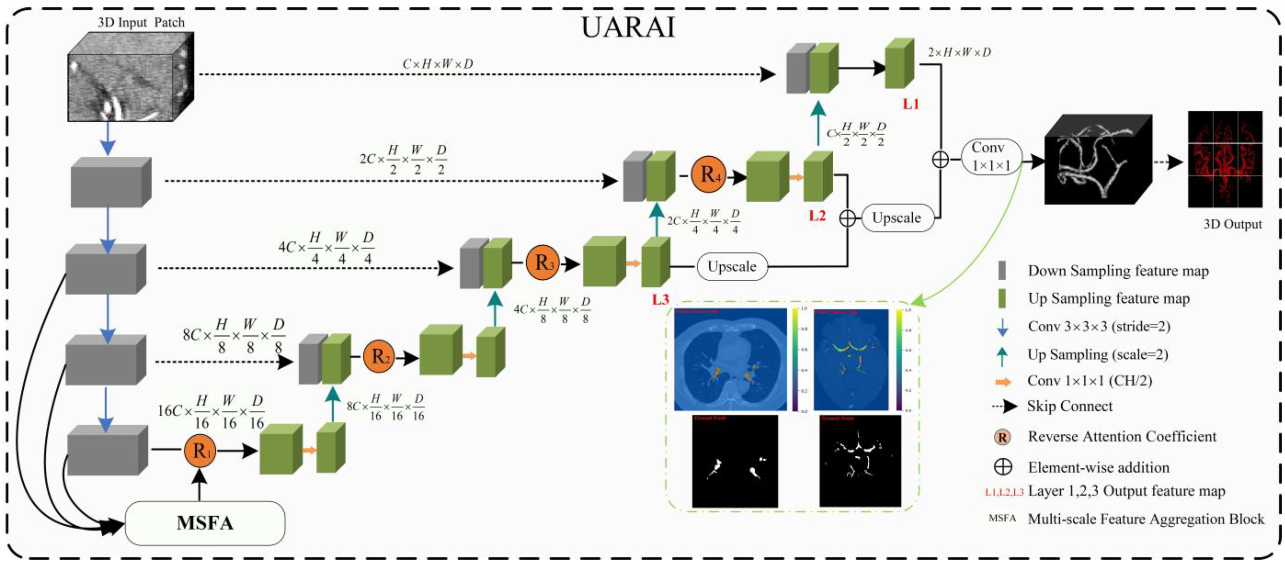 Diagnostics | Free Full-Text | Tubular Structure Segmentation via Multi ...
