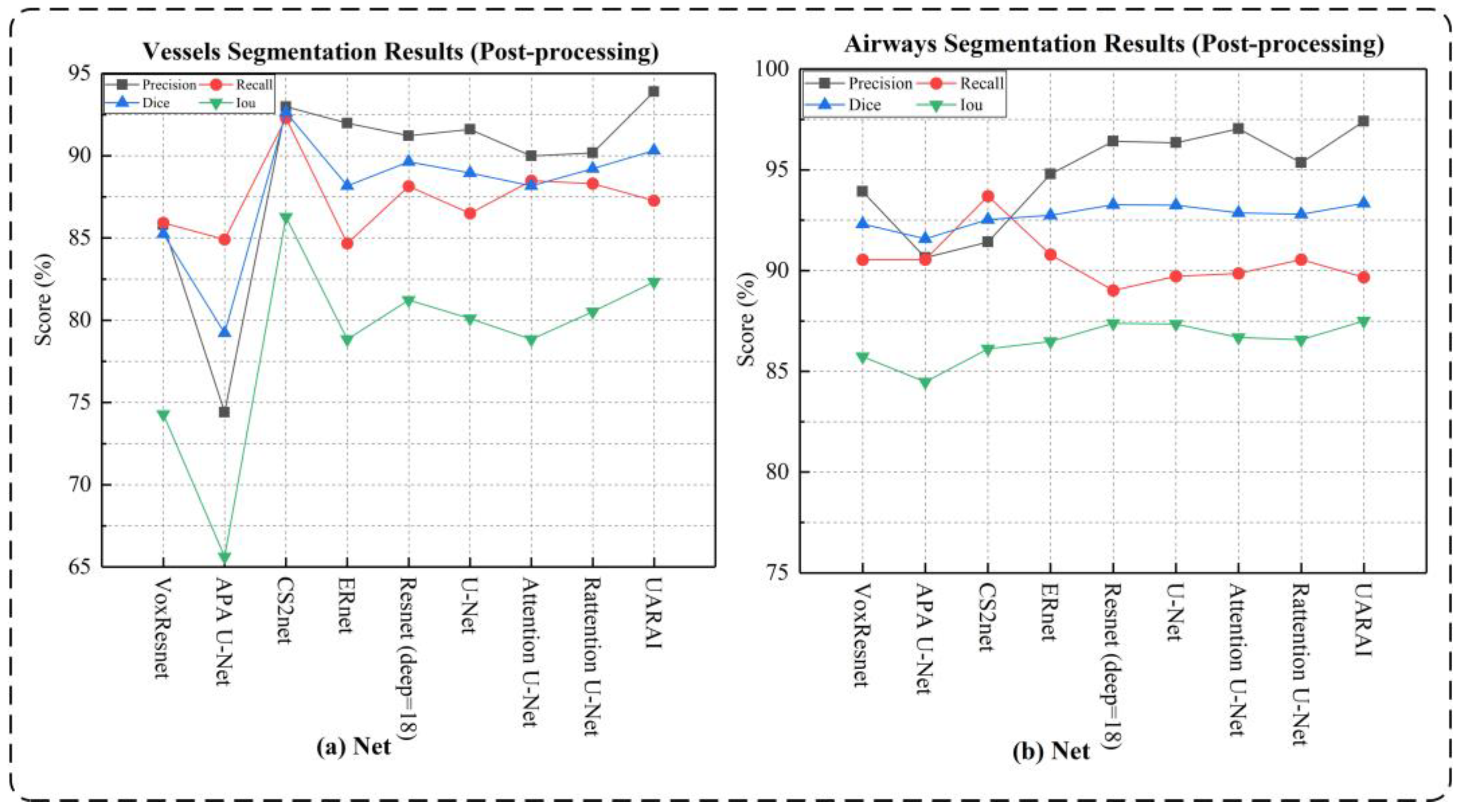 Diagnostics | Free Full-Text | Tubular Structure Segmentation via Multi-Scale Reverse Attention ...