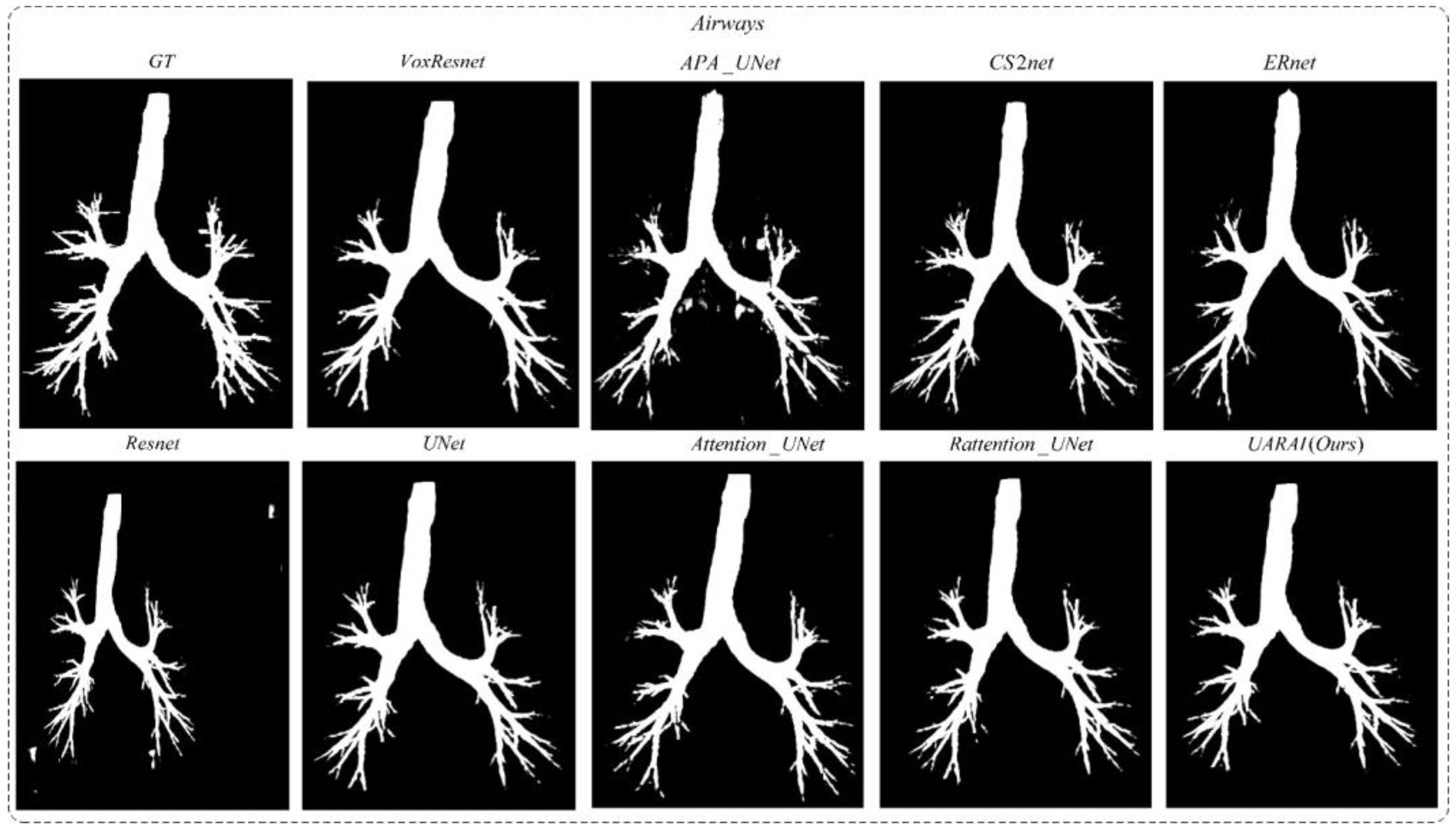 Tubular Structure Segmentation via Multi-Scale Reverse Attention Sparse ...