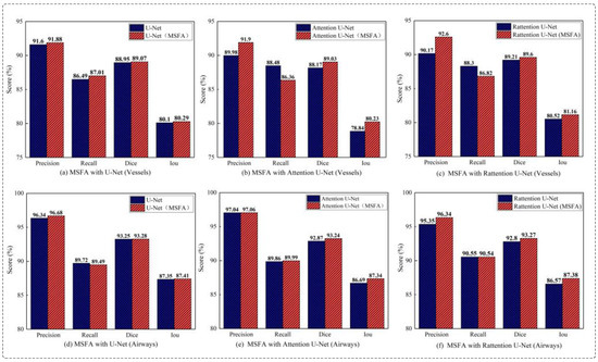 Diagnostics | Free Full-Text | Tubular Structure Segmentation via Multi-Scale Reverse Attention ...