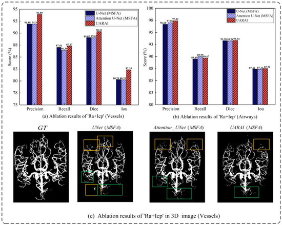 Diagnostics | Free Full-Text | Tubular Structure Segmentation via Multi-Scale Reverse Attention ...