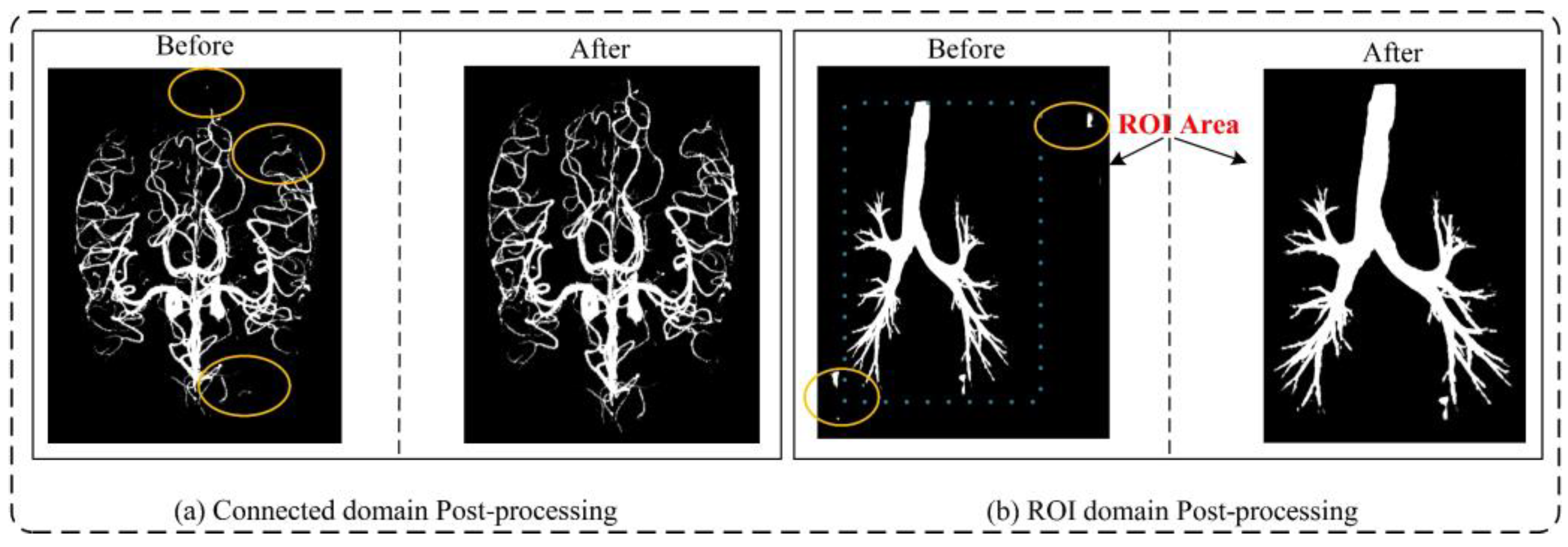 Diagnostics | Free Full-Text | Tubular Structure Segmentation via Multi-Scale Reverse Attention ...