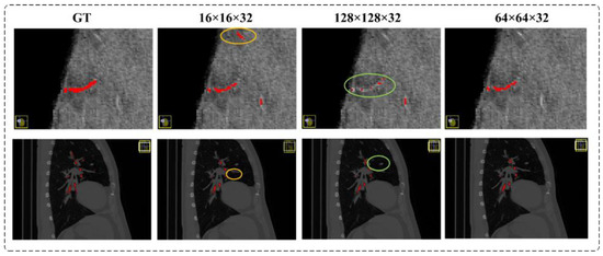 Diagnostics | Free Full-Text | Tubular Structure Segmentation via Multi-Scale Reverse Attention ...