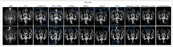 Diagnostics | Free Full-Text | Tubular Structure Segmentation via Multi-Scale Reverse Attention ...