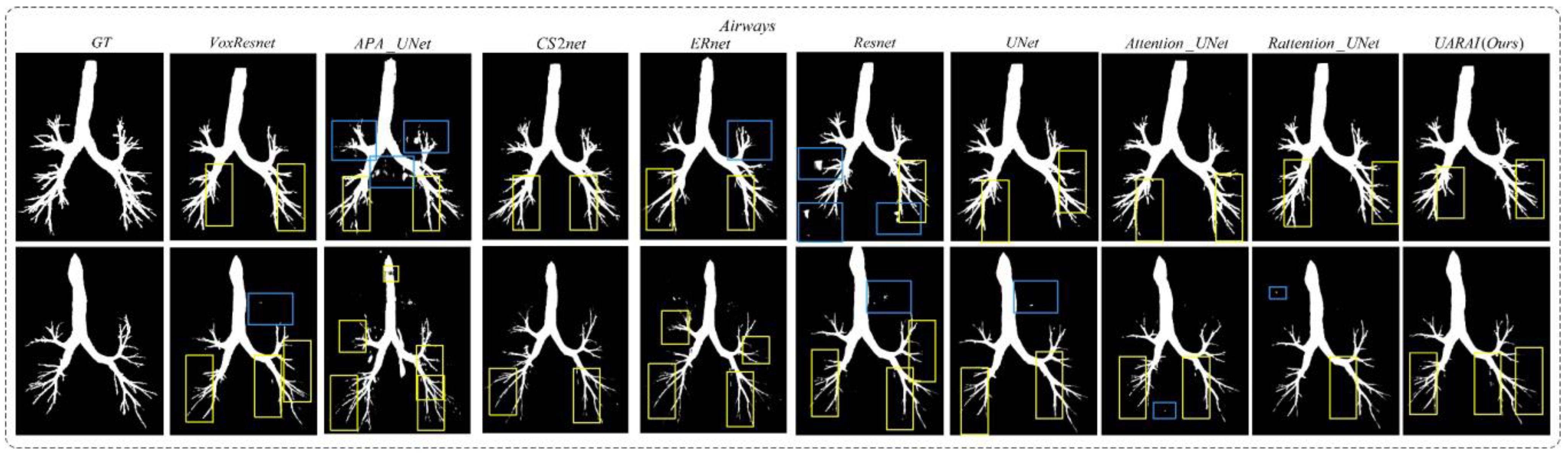 Diagnostics | Free Full-Text | Tubular Structure Segmentation via Multi-Scale Reverse Attention ...