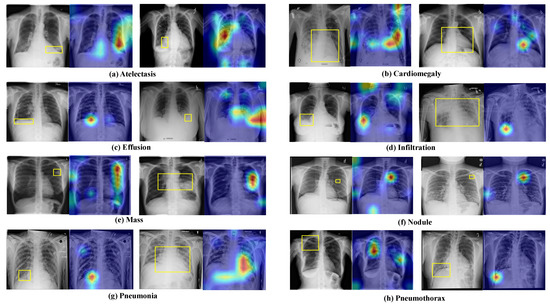 High-Resolution Network with Dynamic Convolution and Coordinate ...