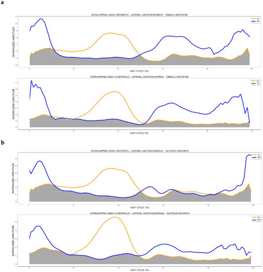 Muscle Coactivation Index during Walking in People with Multiple ...