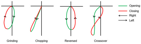 Association between the Temporomandibular Joint Morphology and Chewing ...