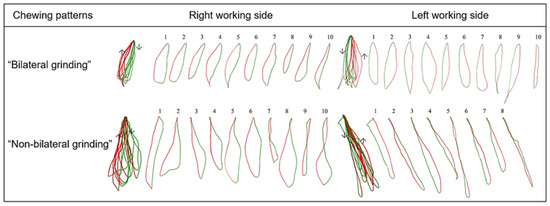 Association between the Temporomandibular Joint Morphology and Chewing ...