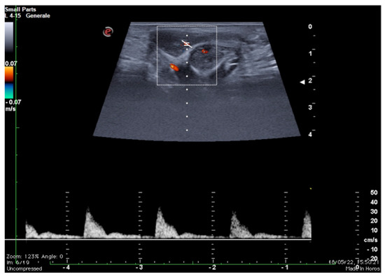 MRI-Cavernosography: A New Diagnostic Tool for Erectile Dysfunction Due ...