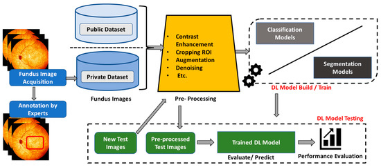 Automated Glaucoma Screening and Diagnosis Based on Retinal Fundus Images Using Deep Learning ...