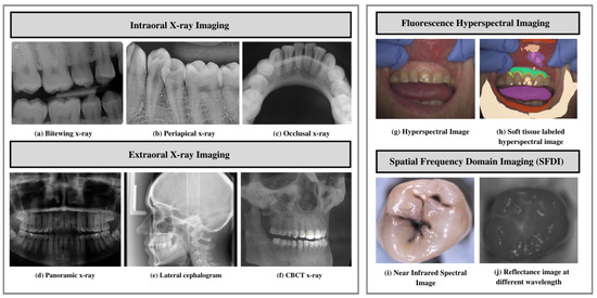 Diagnostics | Free Full-Text | A Comprehensive Review of Recent ...
