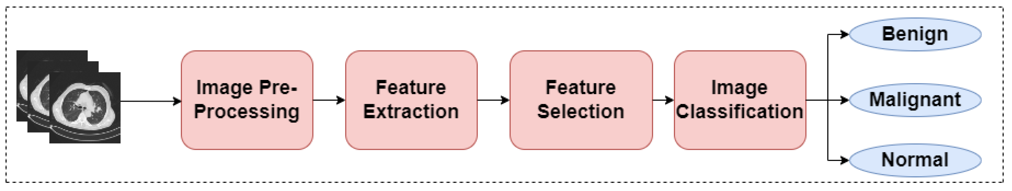 ExtRanFS: An Automated Lung Cancer Malignancy Detection System Using Extremely Randomized ...