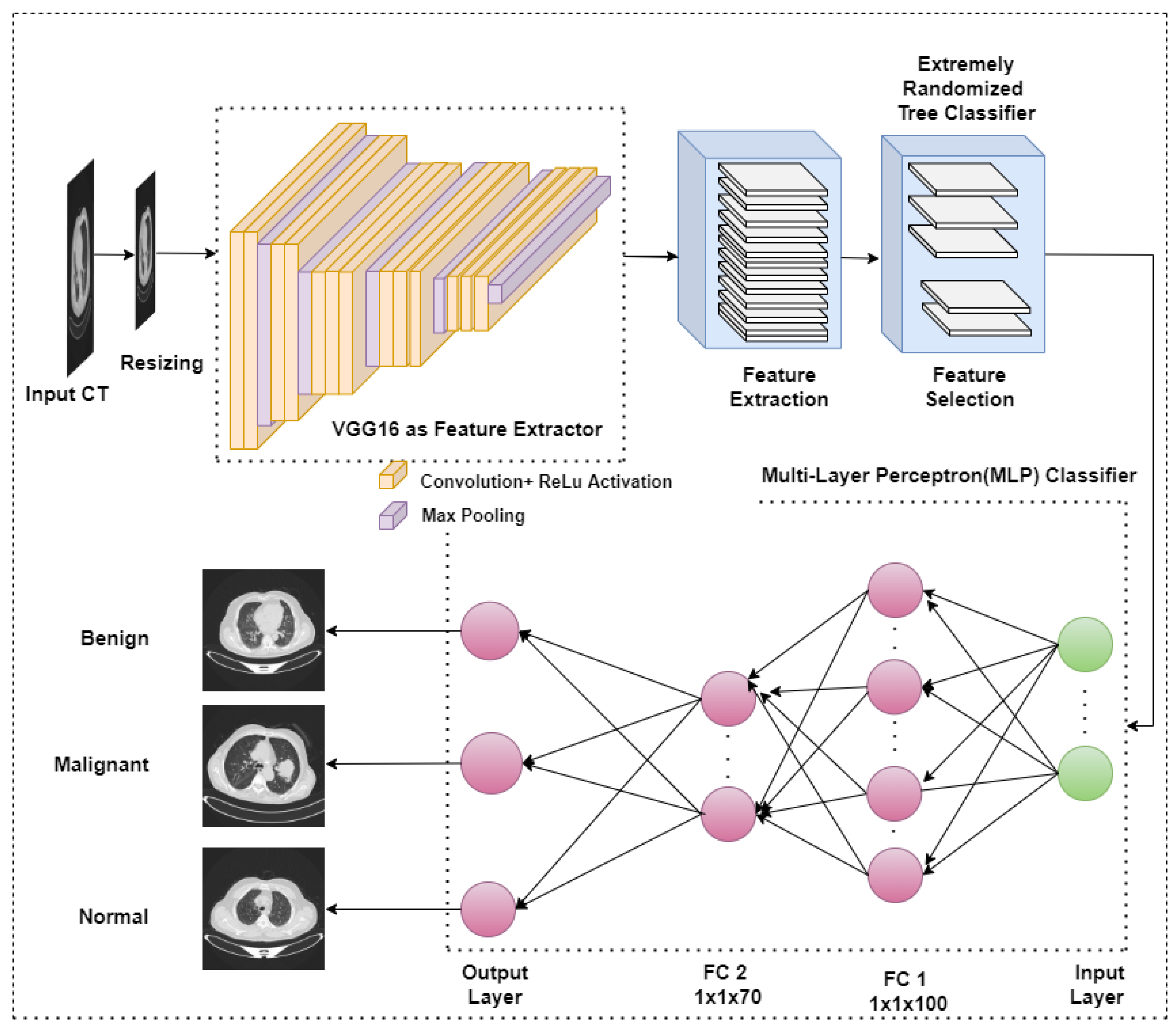 ExtRanFS: An Automated Lung Cancer Malignancy Detection System Using ...
