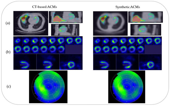 Synthetic Attenuation Correction Maps for SPECT Imaging Using Deep ...