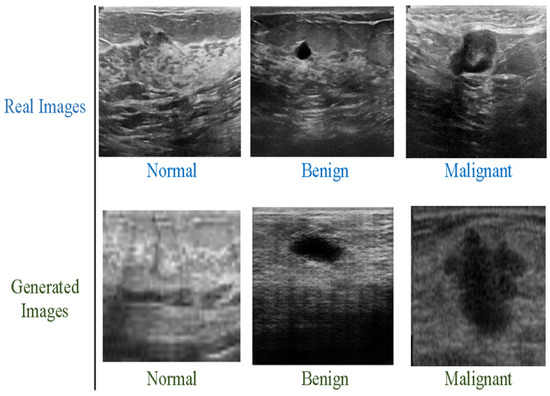 Diagnostics | Free Full-Text | Breast Cancer Classification through ...