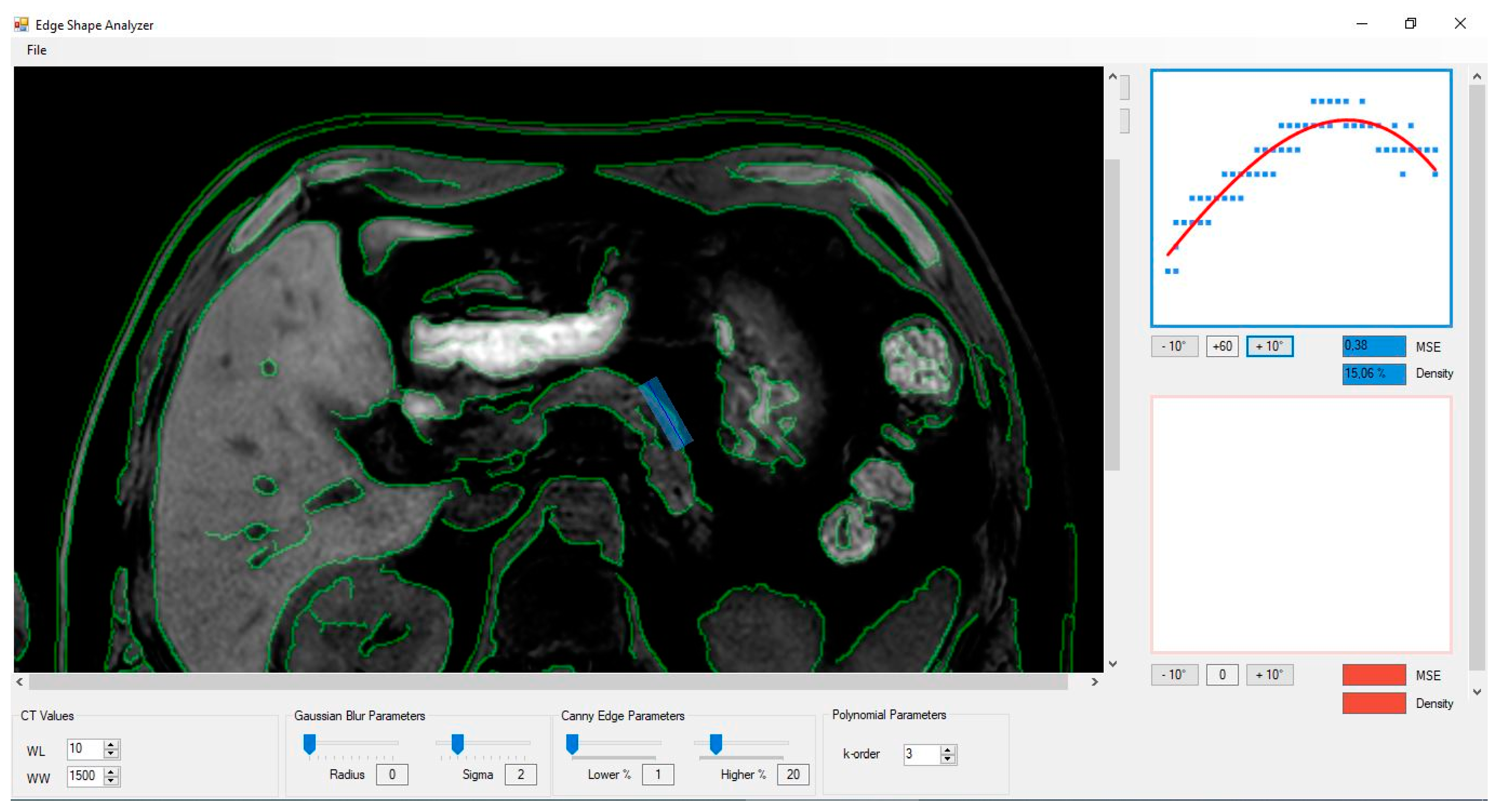 Diagnostics | Free Full-Text | Quantitative Edge Analysis of Pancreatic ...