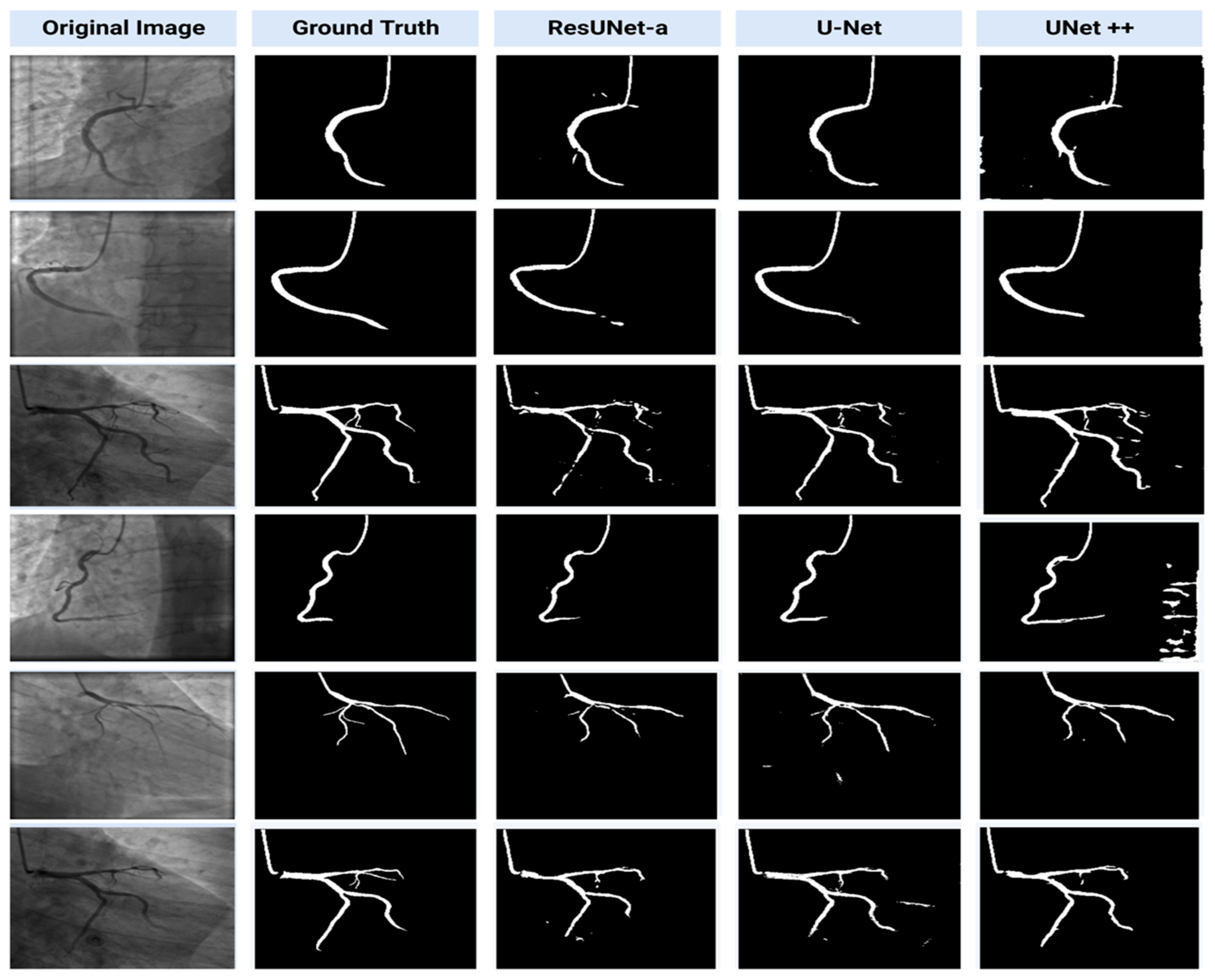 The Application of Deep Learning for the Segmentation and ...