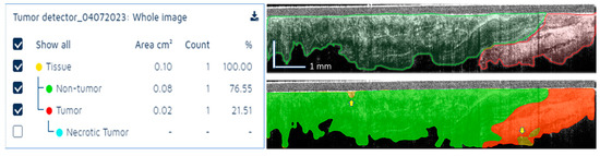 Core Needle Biopsy Guidance Based on Tissue Morphology Assessment with ...