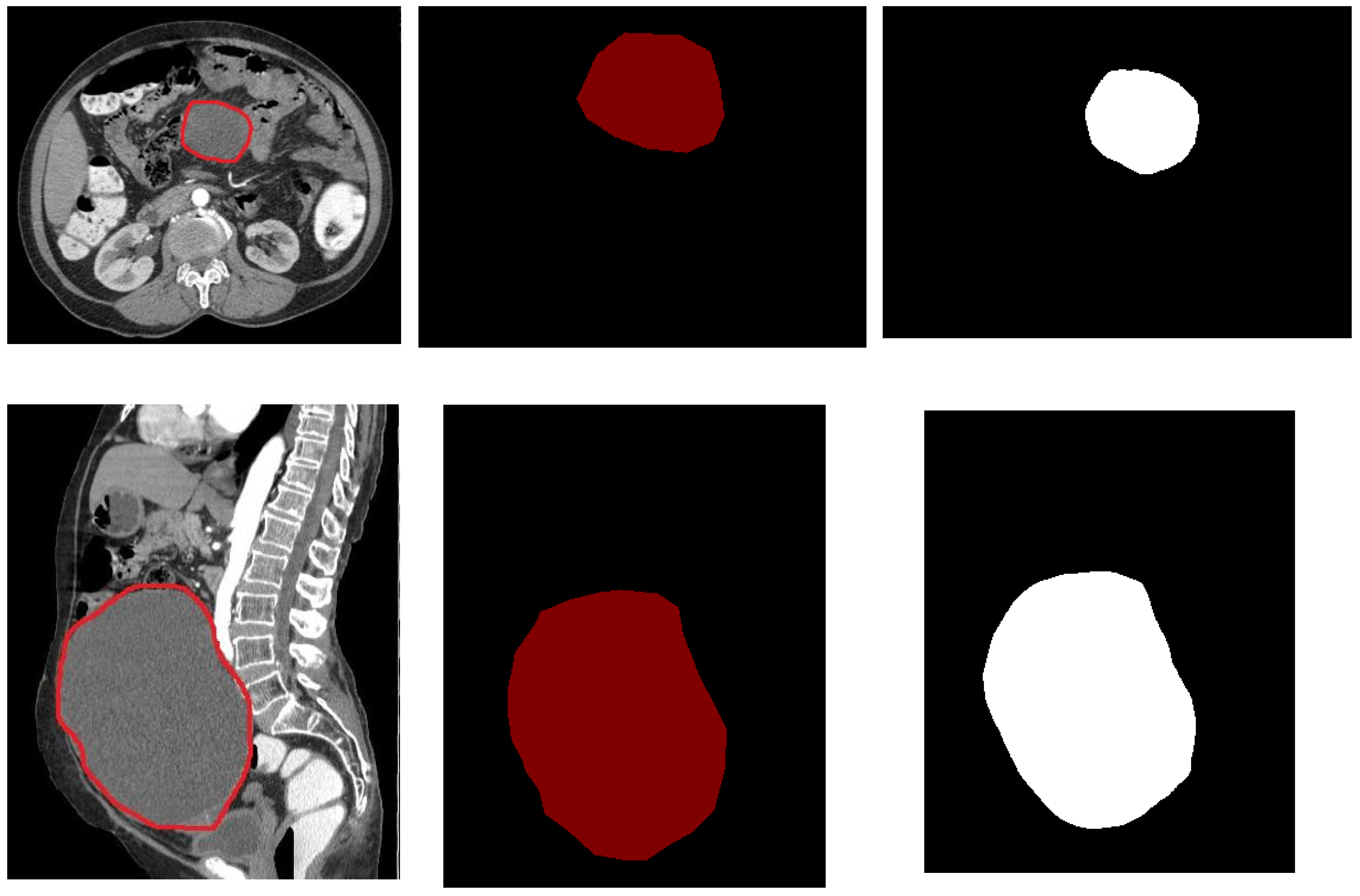 Performance Analysis of Segmentation and Classification of CT-Scanned ...