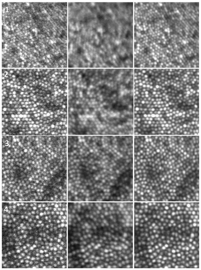 Non-Rigid Registration for High-Resolution Retinal Imaging