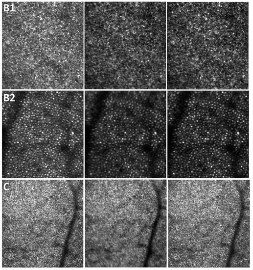 Non-Rigid Registration for High-Resolution Retinal Imaging